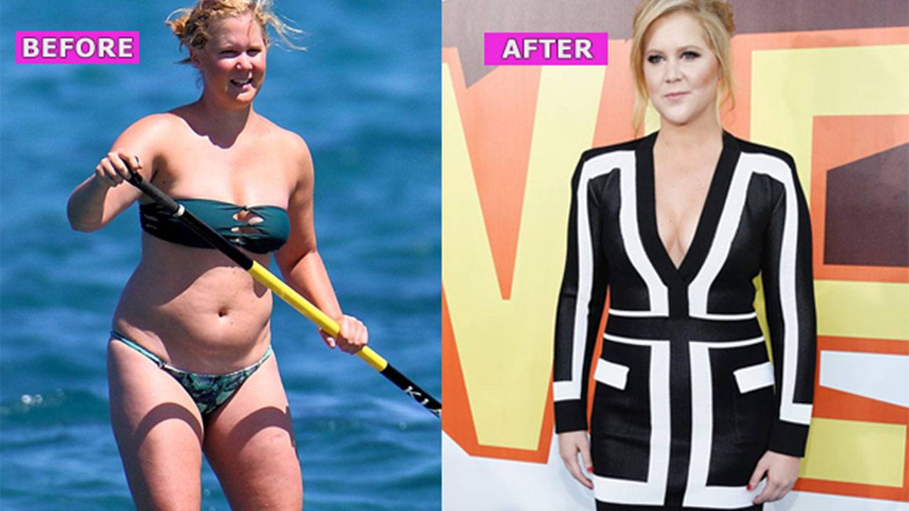 Amy Schumer Moon Face: Is Amy Schumer on Steroids? How Did Amy Schumer Gain Weight? - NAYAG Scoop